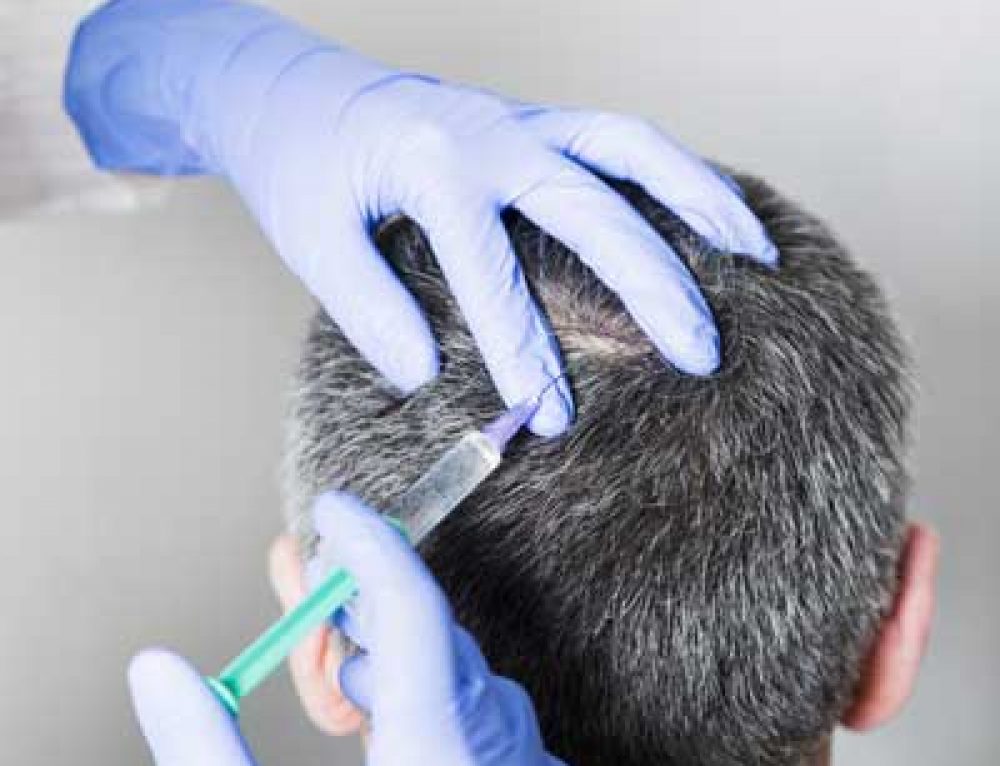 Types of Mesotherapy and Their Effect | MDA